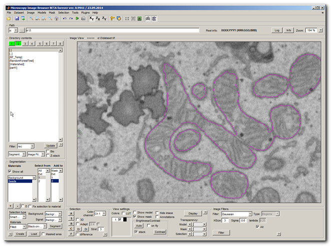 Microscopy Image Browser Watershed/Graphcut segmentation