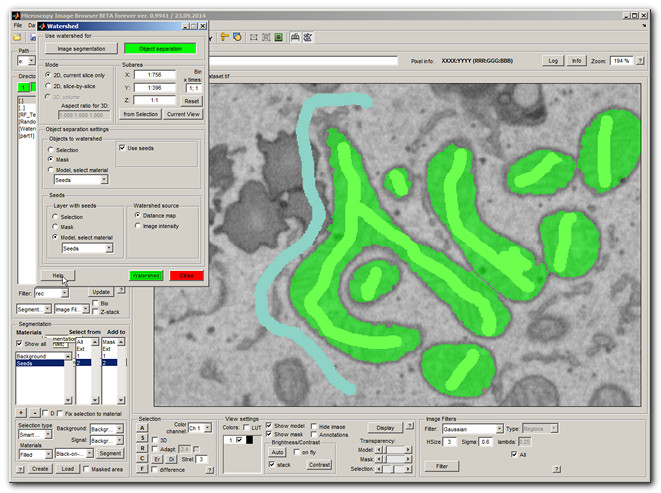Microscopy Image Browser Watershed/Graphcut segmentation